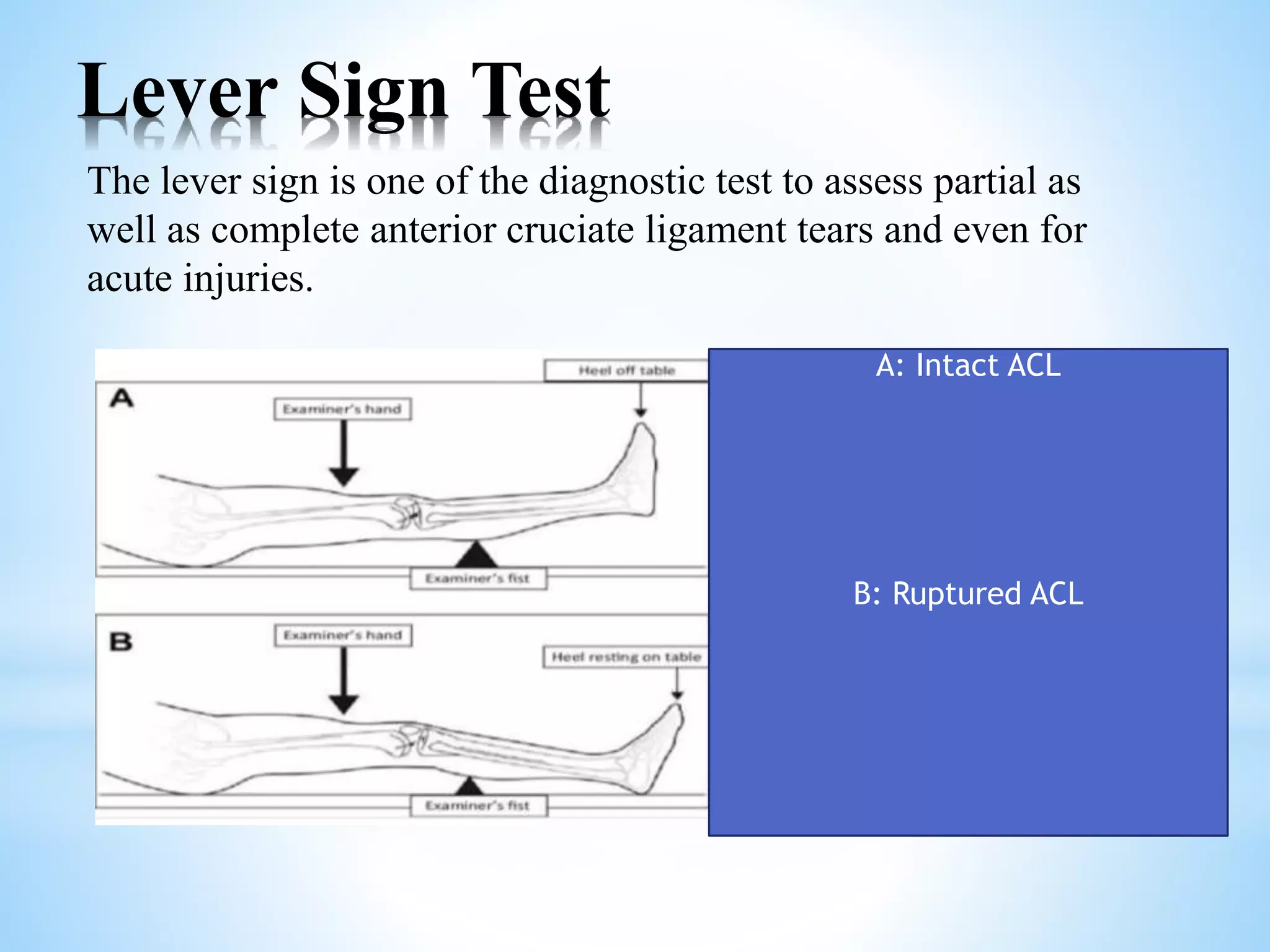 Knee joint anatomy, biomechanics, pathomechanics and assessment | PPTX