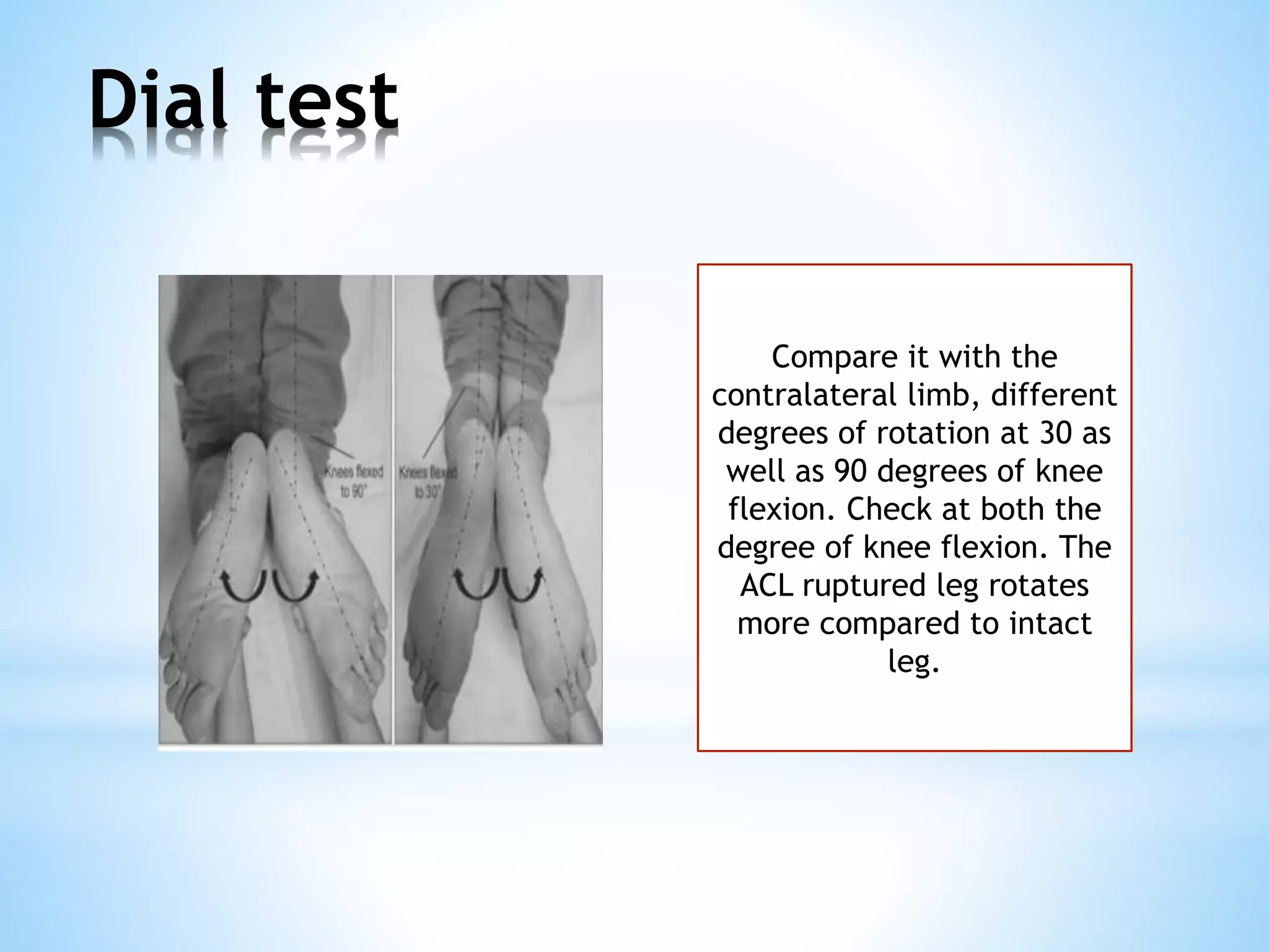 Knee joint anatomy, biomechanics, pathomechanics and assessment | PPTX