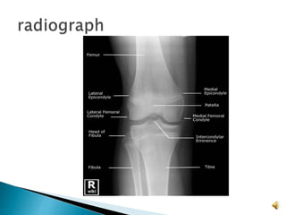 Knee joint ap view | PPTX