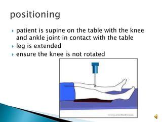 Knee joint ap view | PPTX