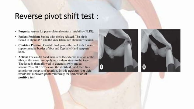 Knee Joint Assessment Tests and Mobilizations | PPTX | Death, Injury ...