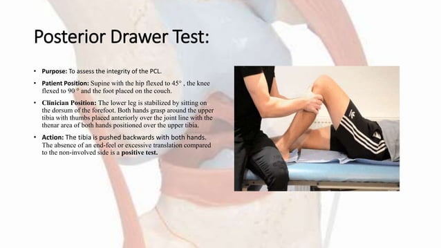 Knee Joint Assessment Tests and Mobilizations | PPTX | Death, Injury ...