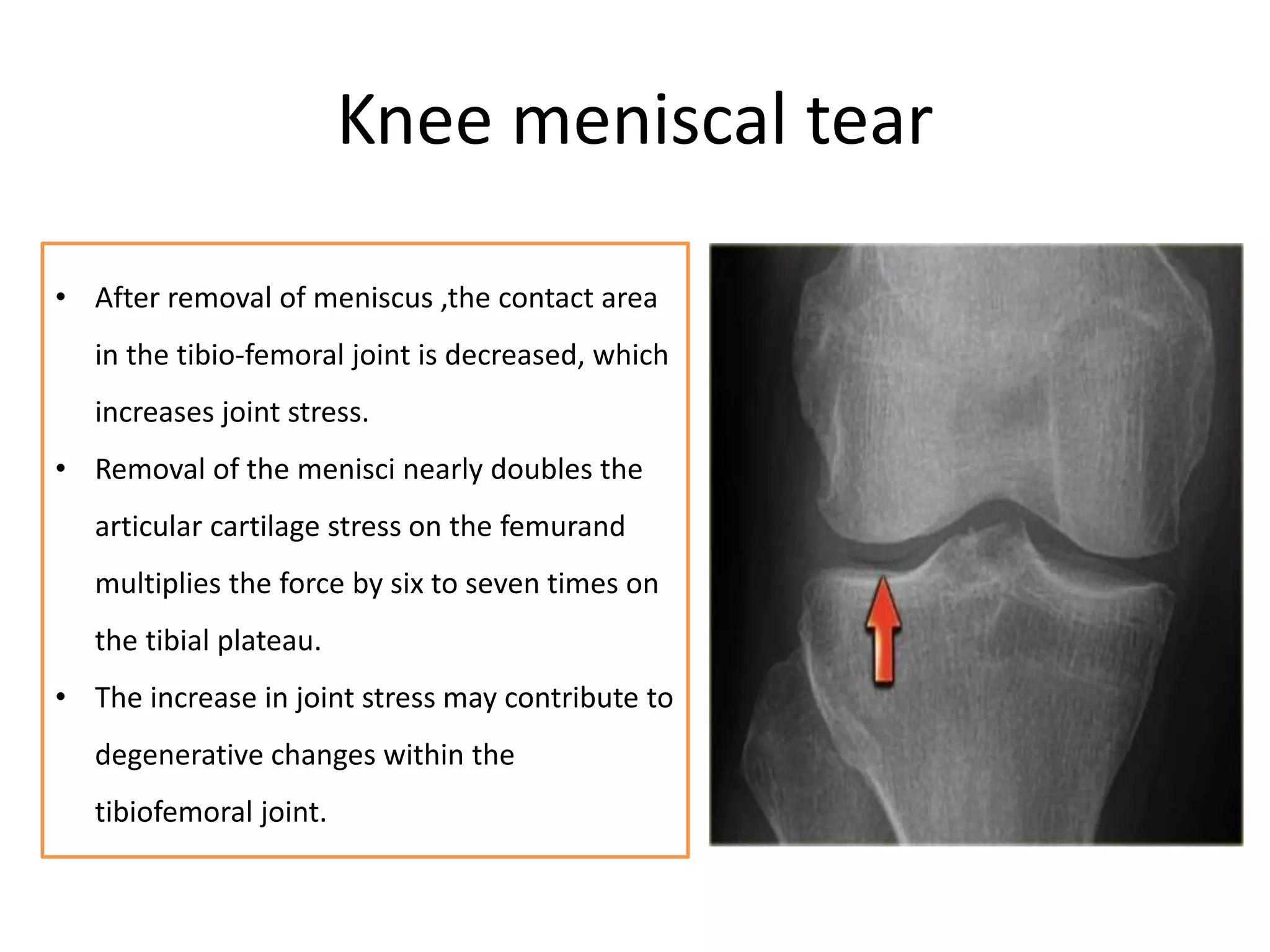 Knee joint biomechanics | PPTX