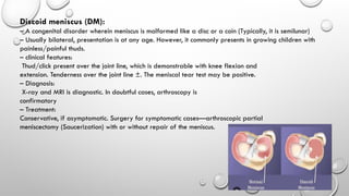 knee joint clinical involving conditions | PPTX