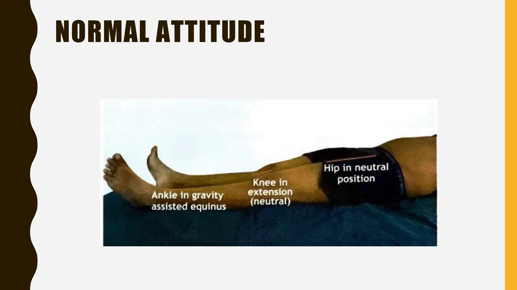 knee joint examination and common testss | PPT