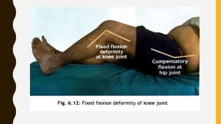 knee joint examination and common testss | PPT
