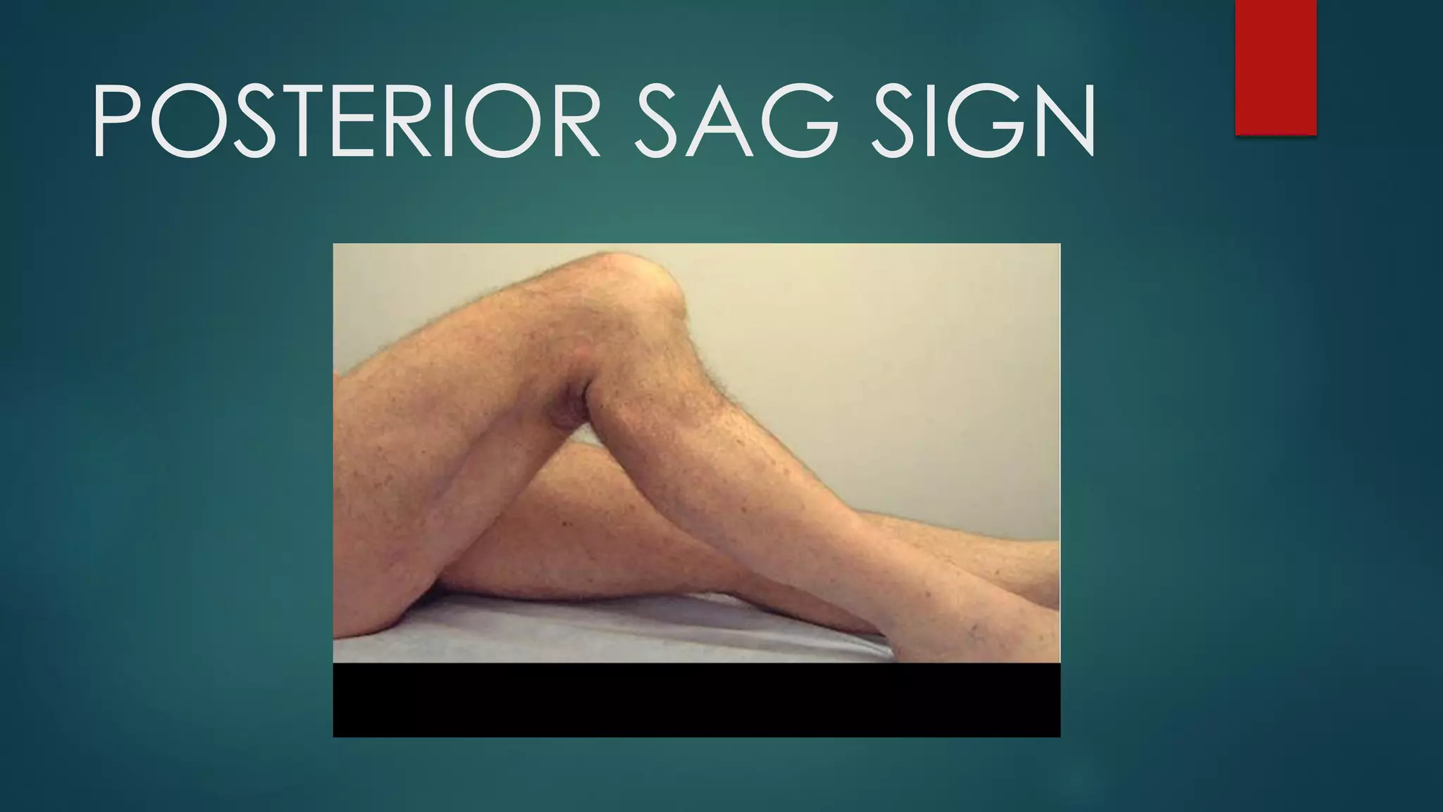 PS SESSION : EXAMINATION OF KNEE JOINT | PDF