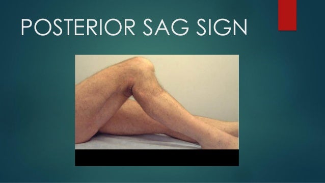 PS SESSION : EXAMINATION OF KNEE JOINT