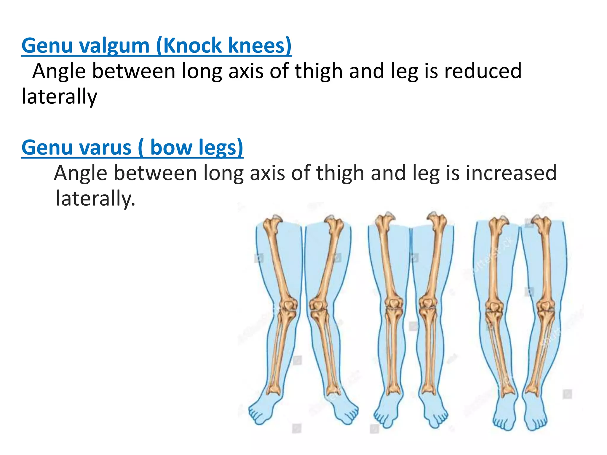KNEE JOINT GK.pptx | Death, Injury, or Military Conflict | Sensitive Topics