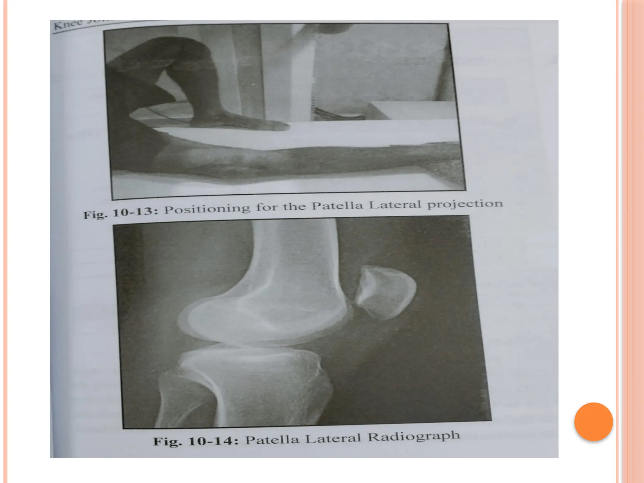 KNEE JOINT Clinical Radiography Positioning.pptx