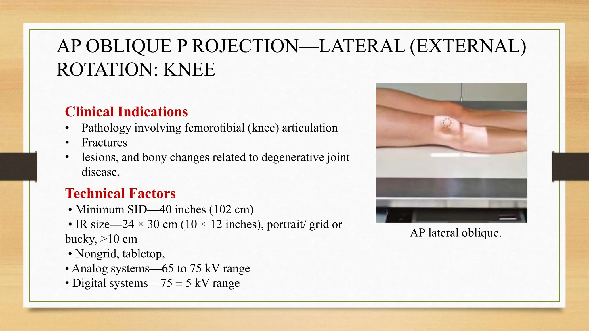 Knee joint (Radiographic projection's) | PPTX