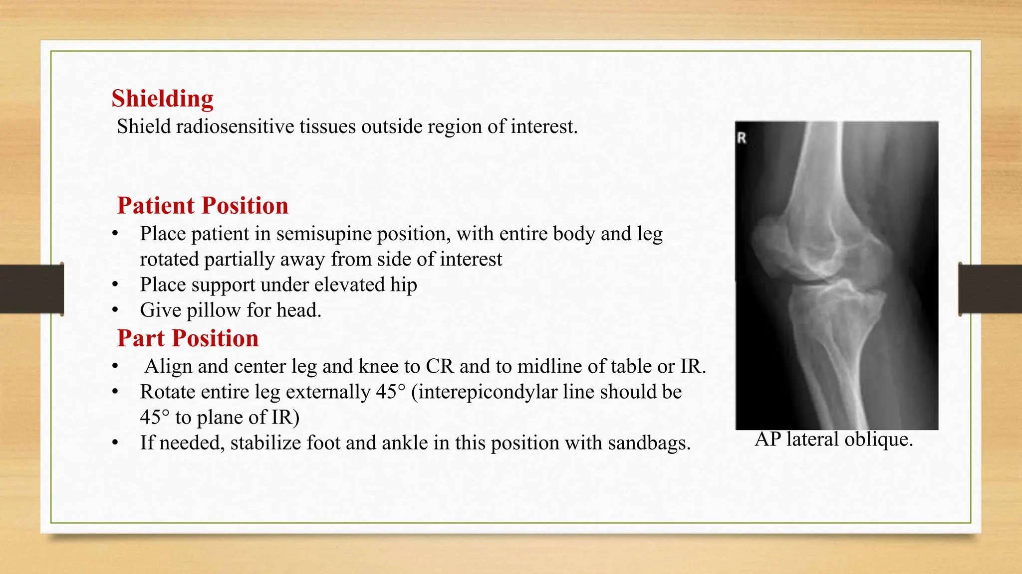 Knee joint (Radiographic projection's) | PPTX
