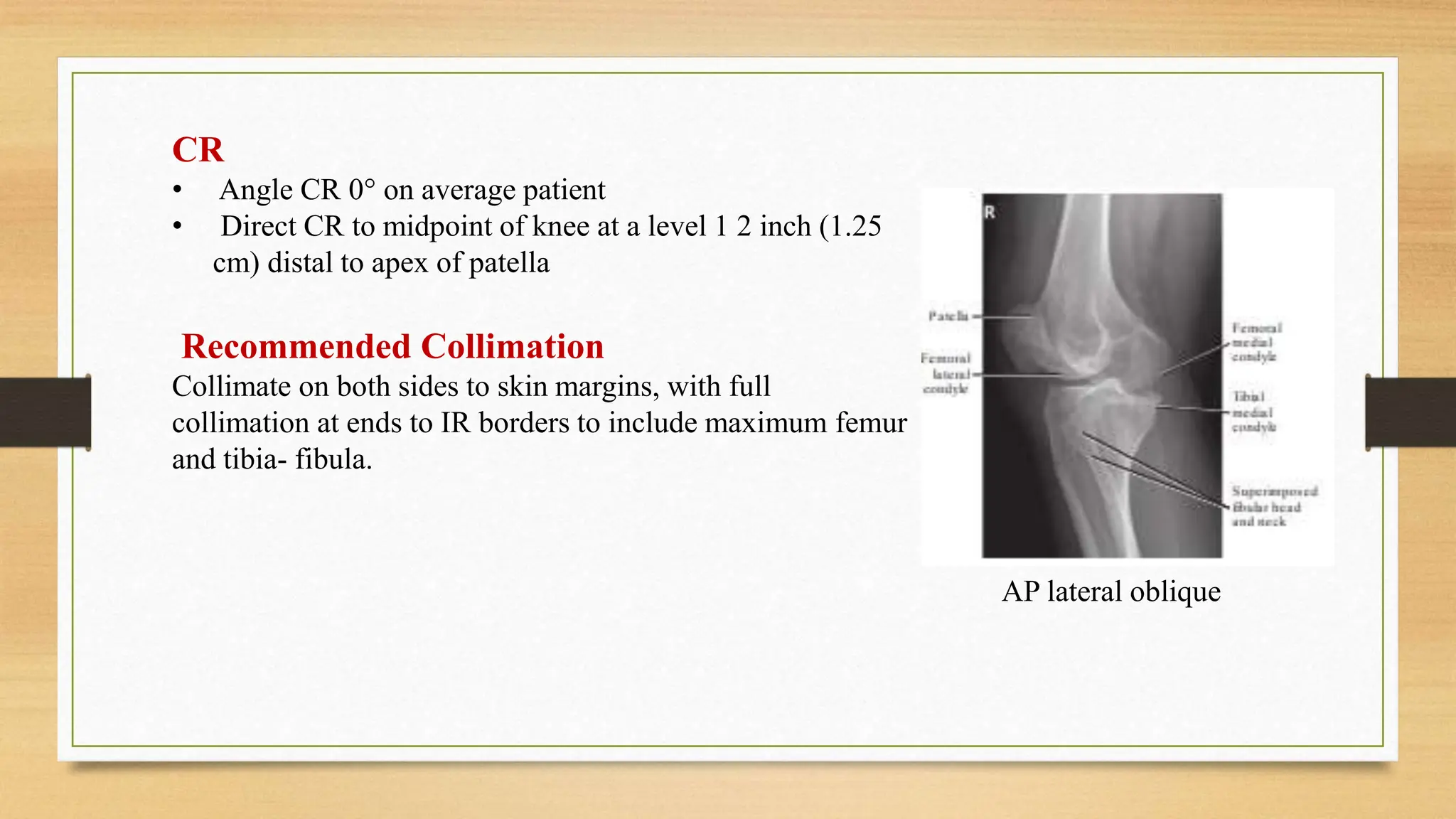 Knee joint (Radiographic projection's) | PPTX