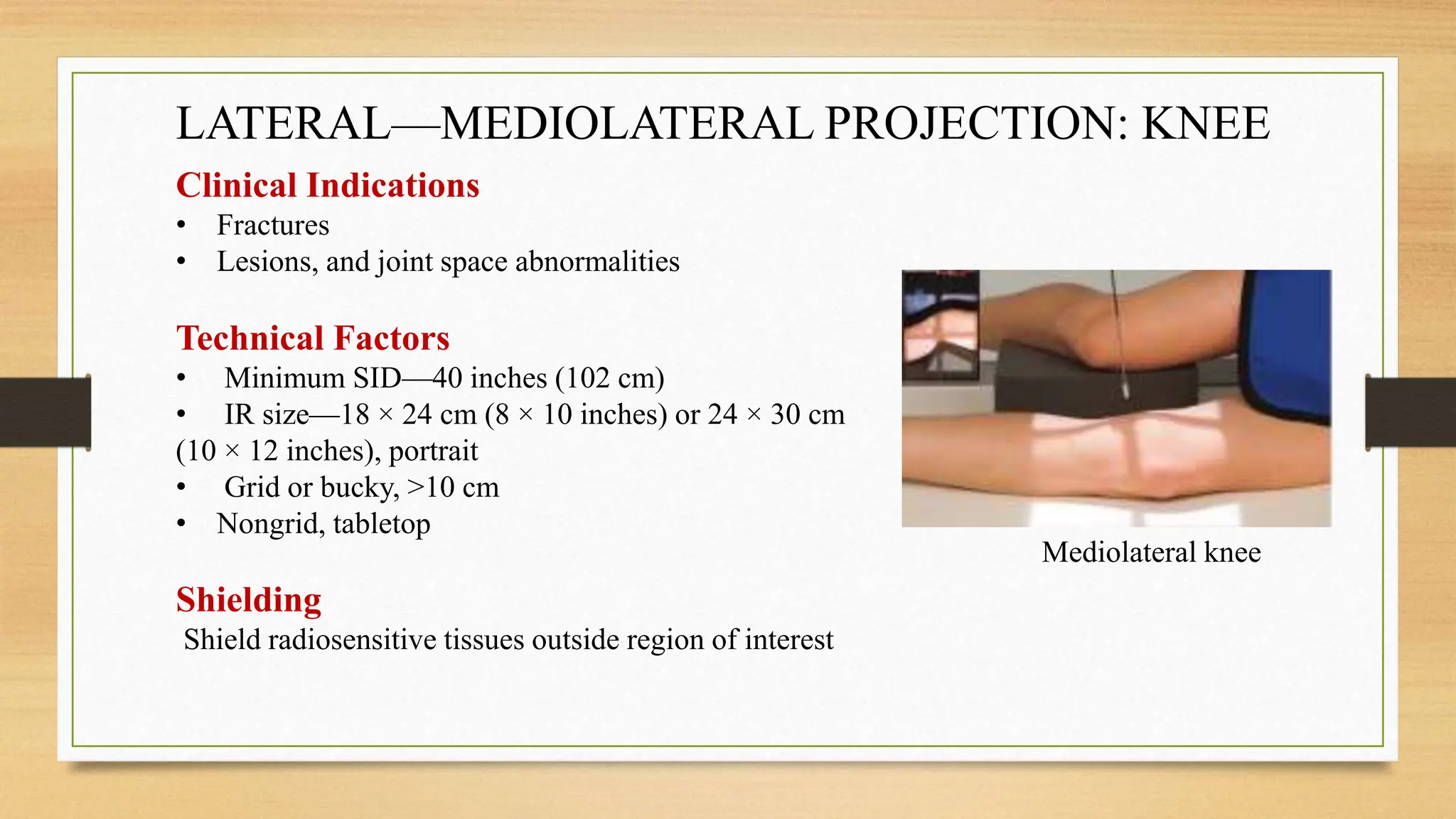 Knee joint (Radiographic projection's) | PPTX