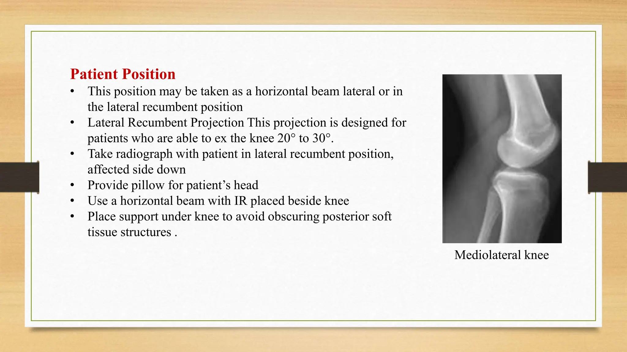 Knee joint (Radiographic projection's) | PPTX