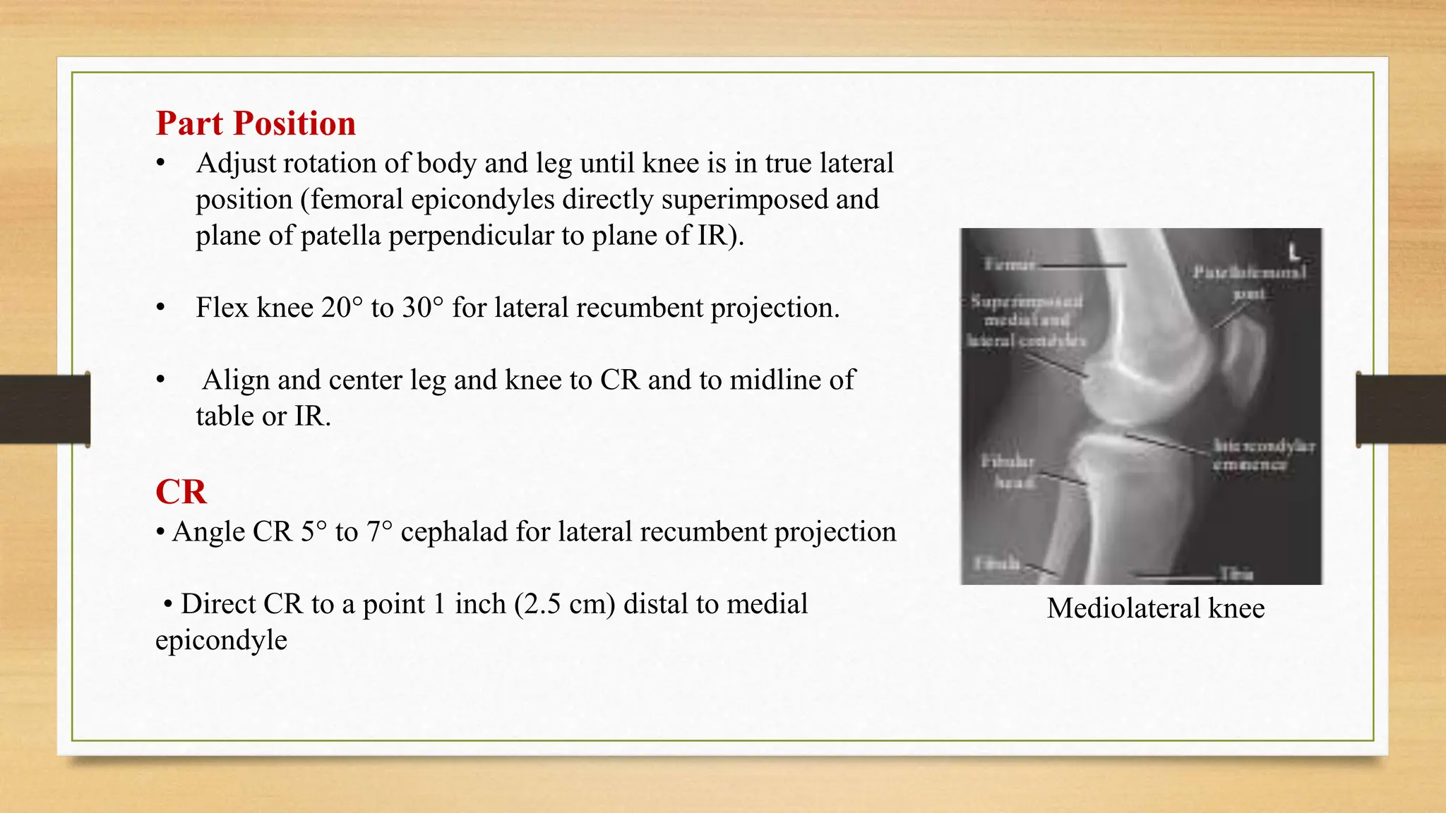 Knee joint (Radiographic projection's) | PPTX