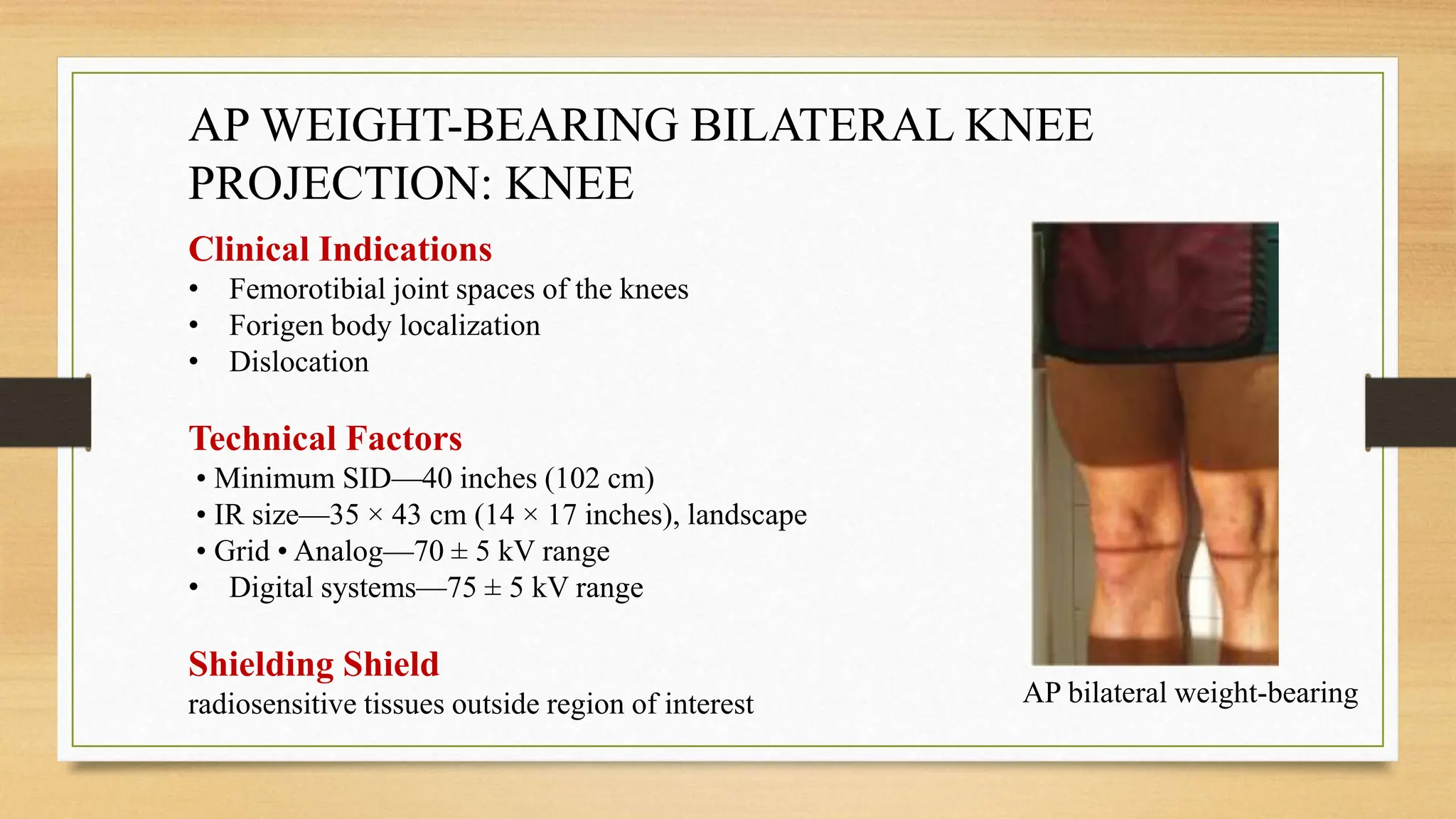 Knee joint (Radiographic projection's) | PPTX