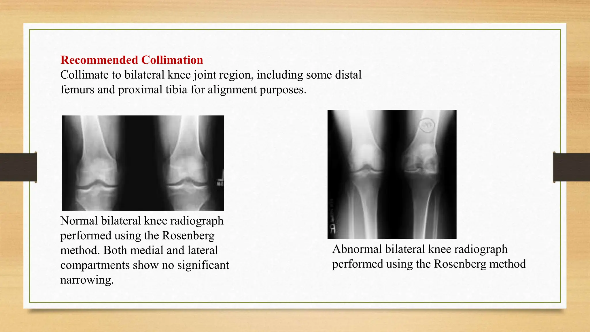Knee joint (Radiographic projection's) | PPTX