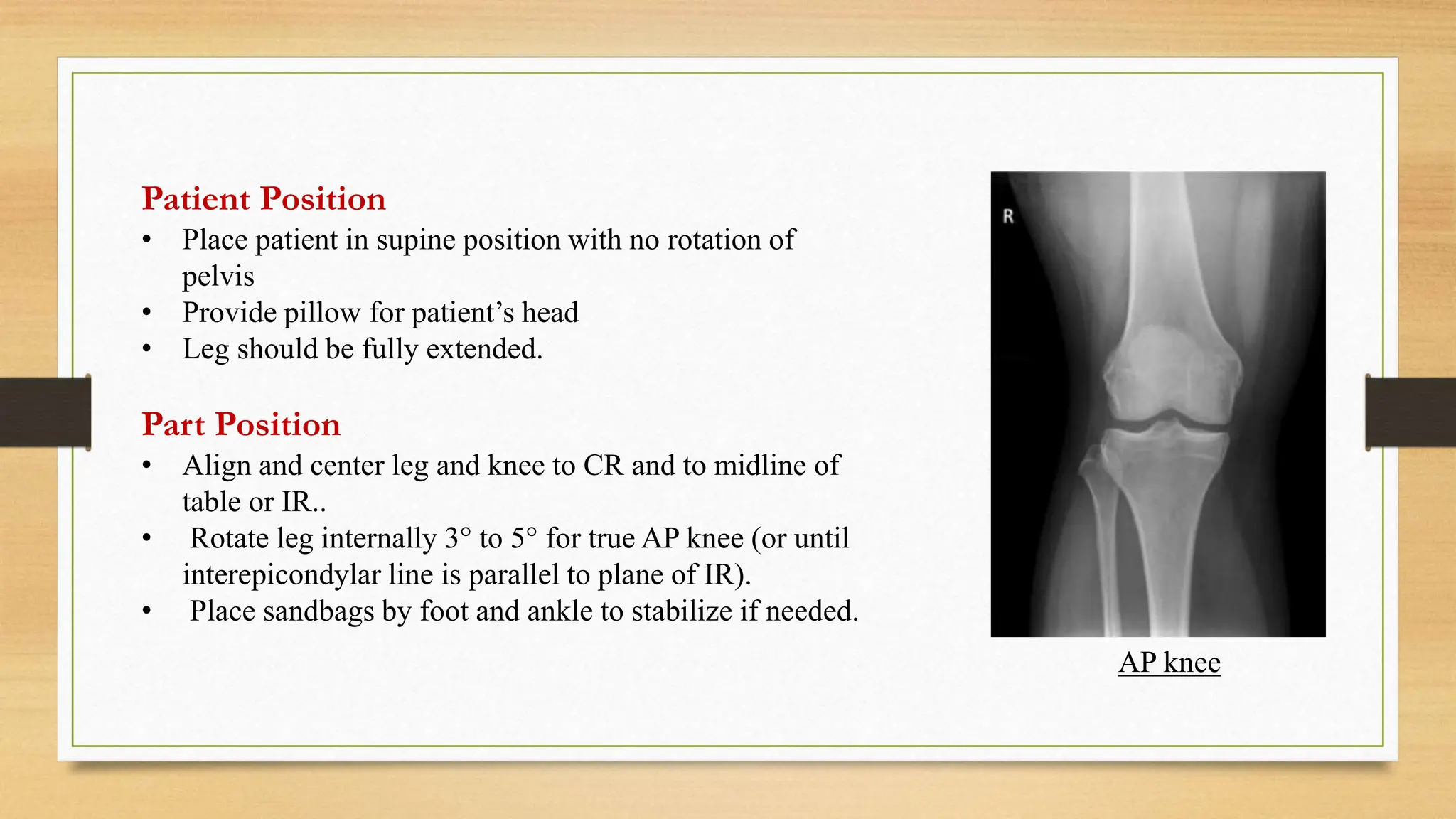 Knee joint (Radiographic projection's) | PPTX