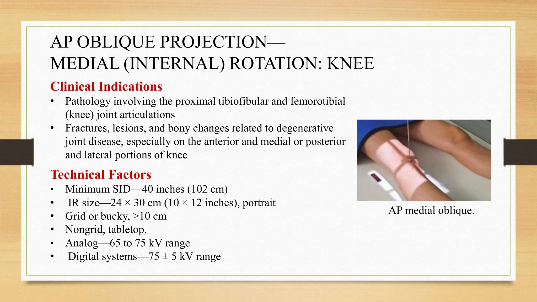 Knee joint (Radiographic projection's) | PPTX