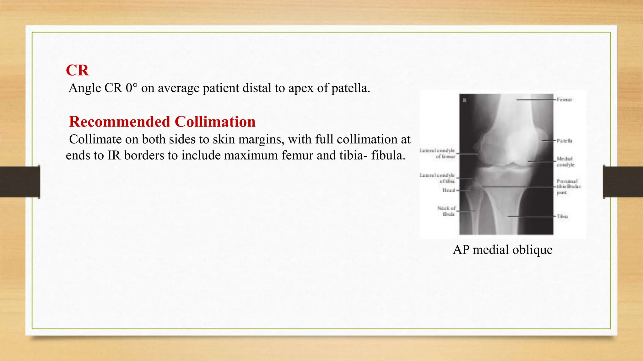 Knee joint (Radiographic projection's) | PPTX