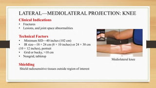 Knee joint (Radiographic projection's) | PPTX