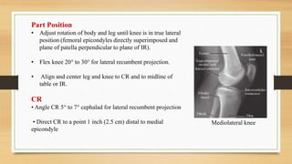 Knee joint (Radiographic projection's) | PPTX