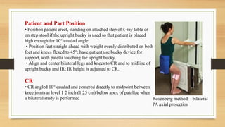 Knee joint (Radiographic projection's) | PPTX