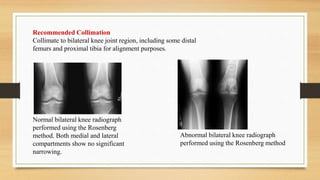 Knee joint (Radiographic projection's) | PPTX