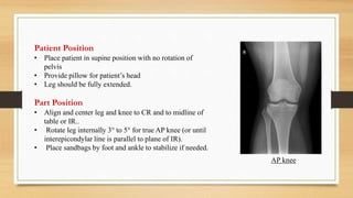 Knee joint (Radiographic projection's) | PPTX