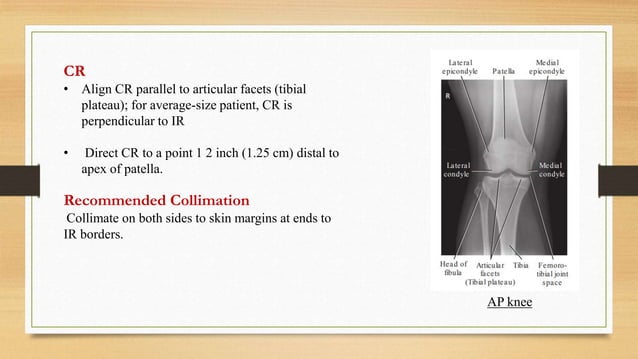 Knee joint (Radiographic projection's) | PPTX | Death, Injury, or ...