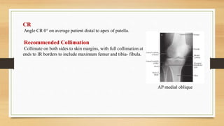 Knee joint (Radiographic projection's) | PPTX