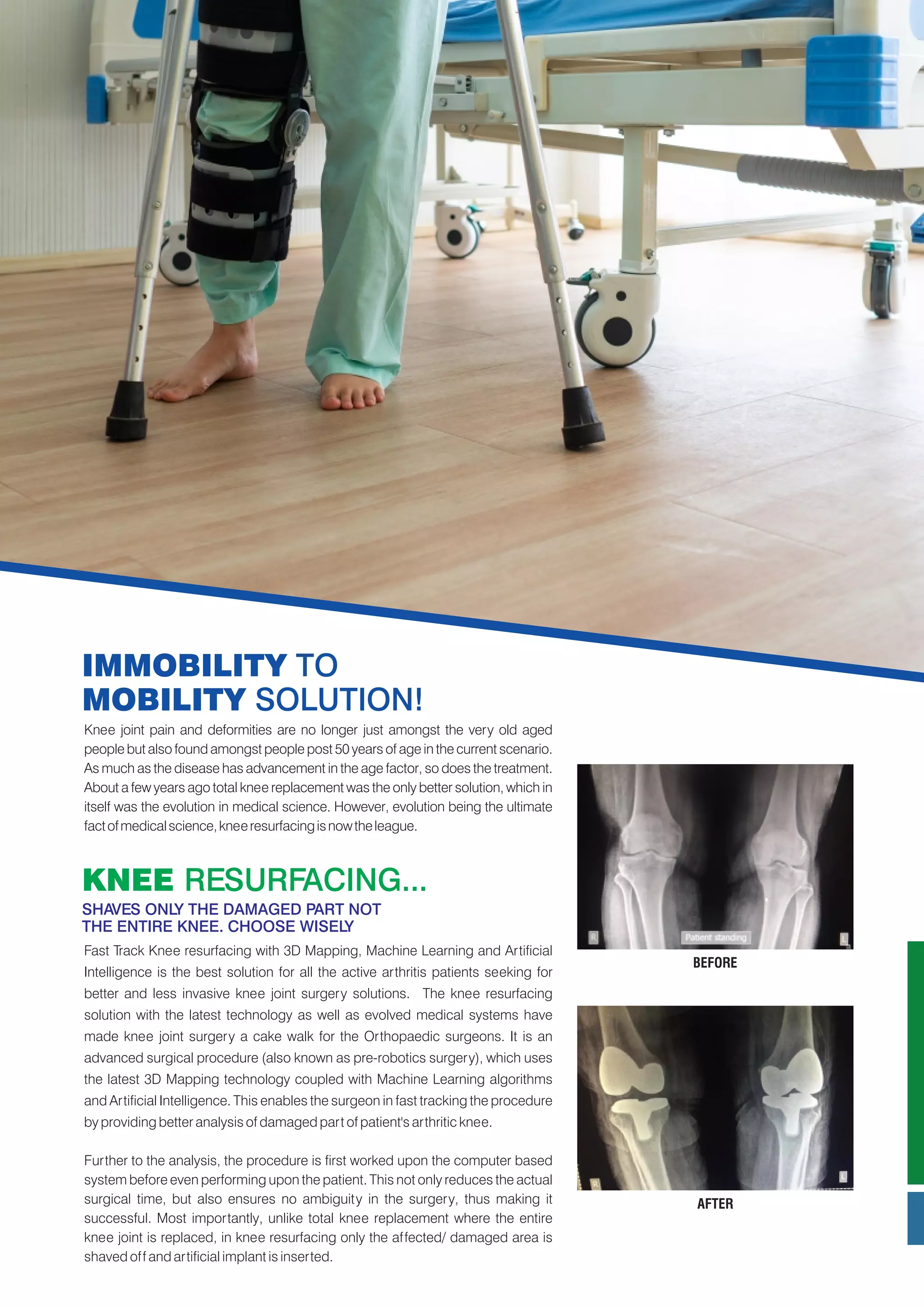 Knee joint resurfacing solution | PDF