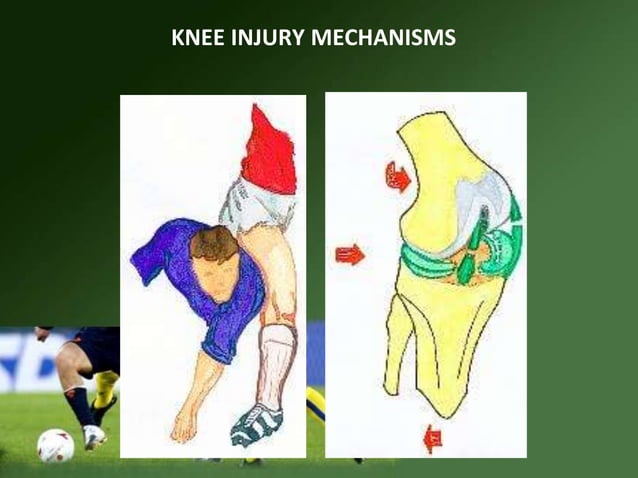 Knee joint applied mechanics - an overview | PPT