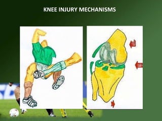 Knee joint applied mechanics - an overview | PPTX