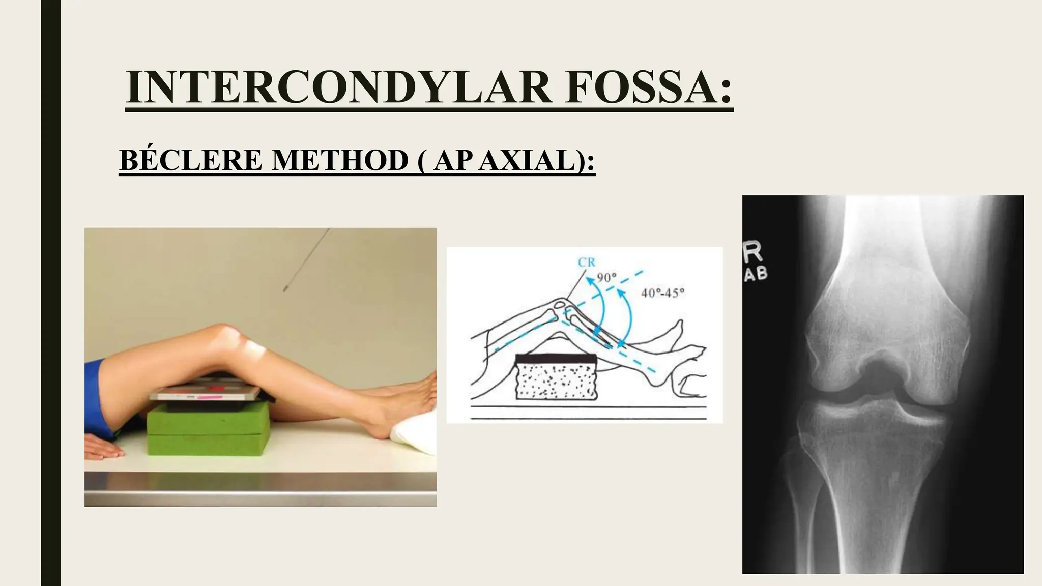 radiography positioning of knee and leg | PPTX