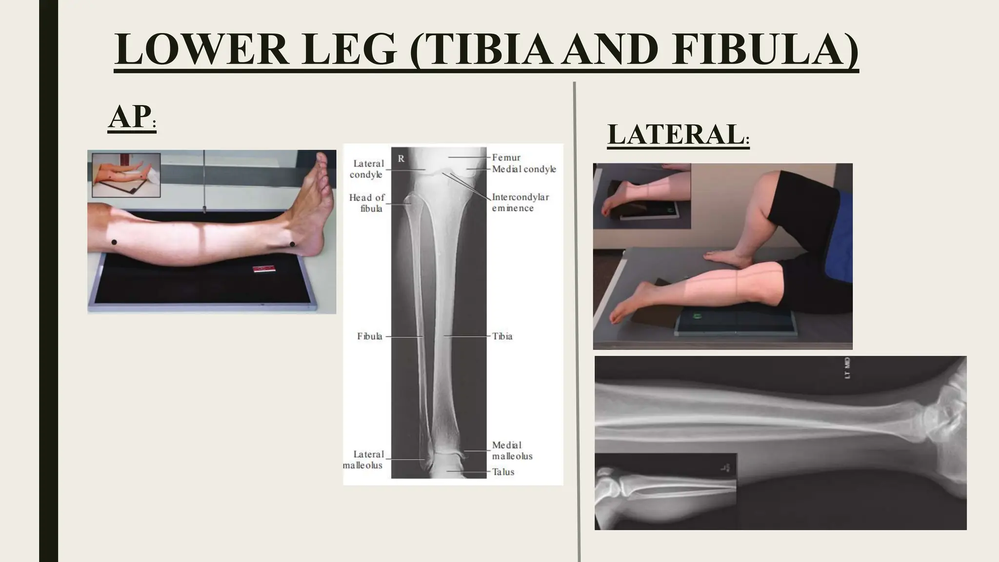 radiography positioning of knee and leg | PPTX