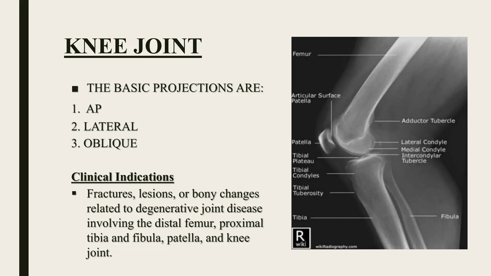 radiography positioning of knee and leg | PPTX