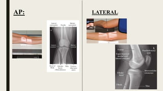 radiography positioning of knee and leg | PPTX