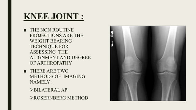 radiography positioning of knee and leg | PPTX