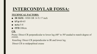 radiography positioning of knee and leg | PPTX