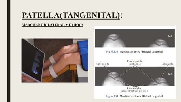 radiography positioning of knee and leg | PPTX