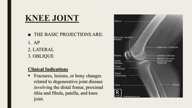 radiography positioning of knee and leg | PPTX