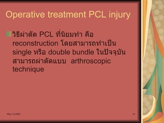 Knee Ligament Injuries | PPT