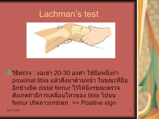 Knee Ligament Injuries | PPT