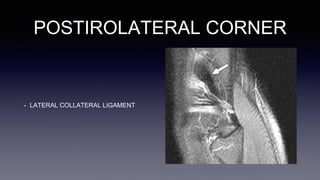 Knee ligament injury mri scan | PPT