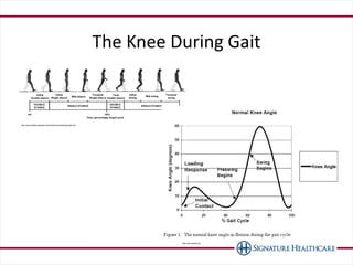 Knee Ligament Lecture | PPT