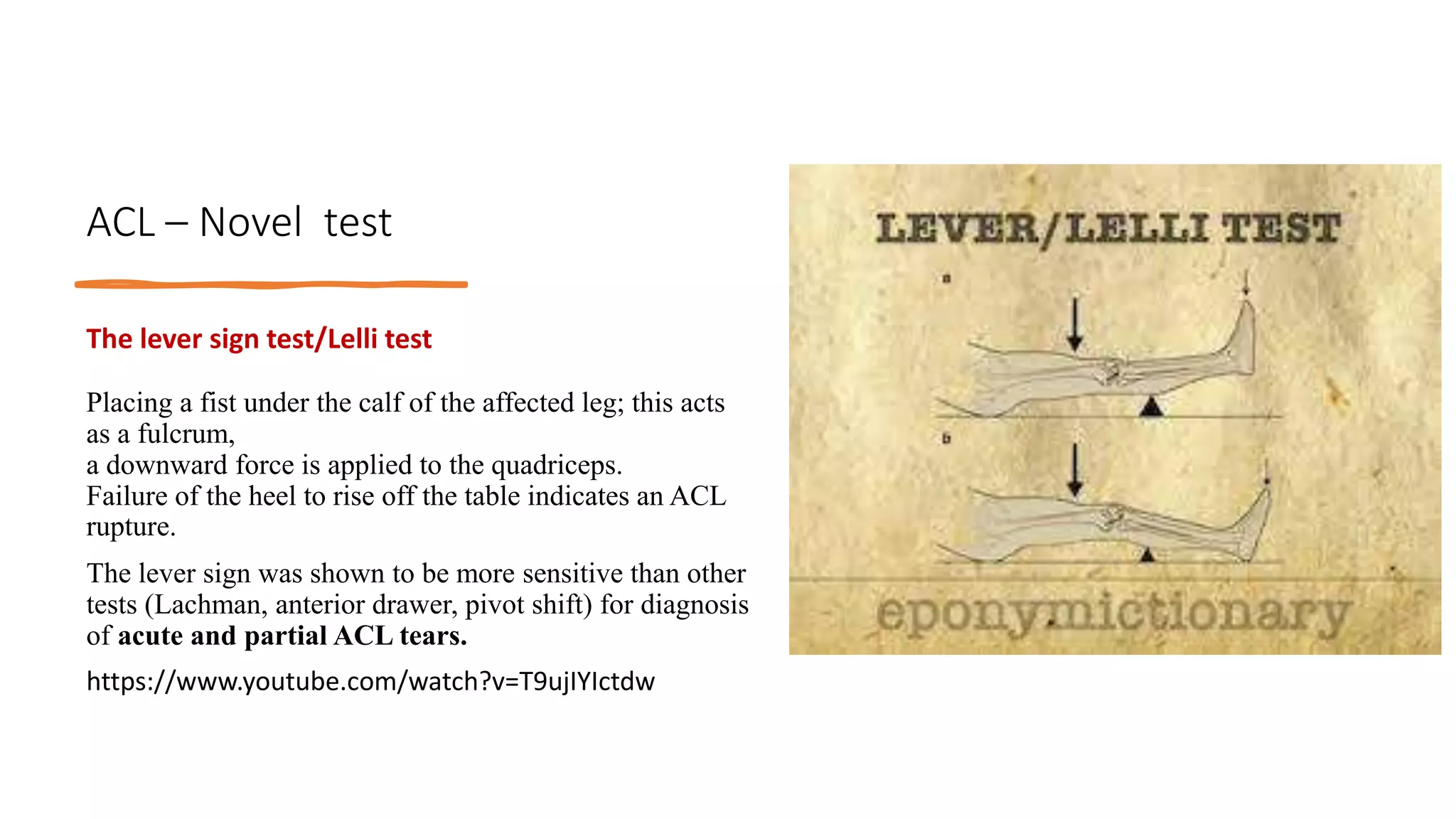 knee ligaments injury Examination.pptx