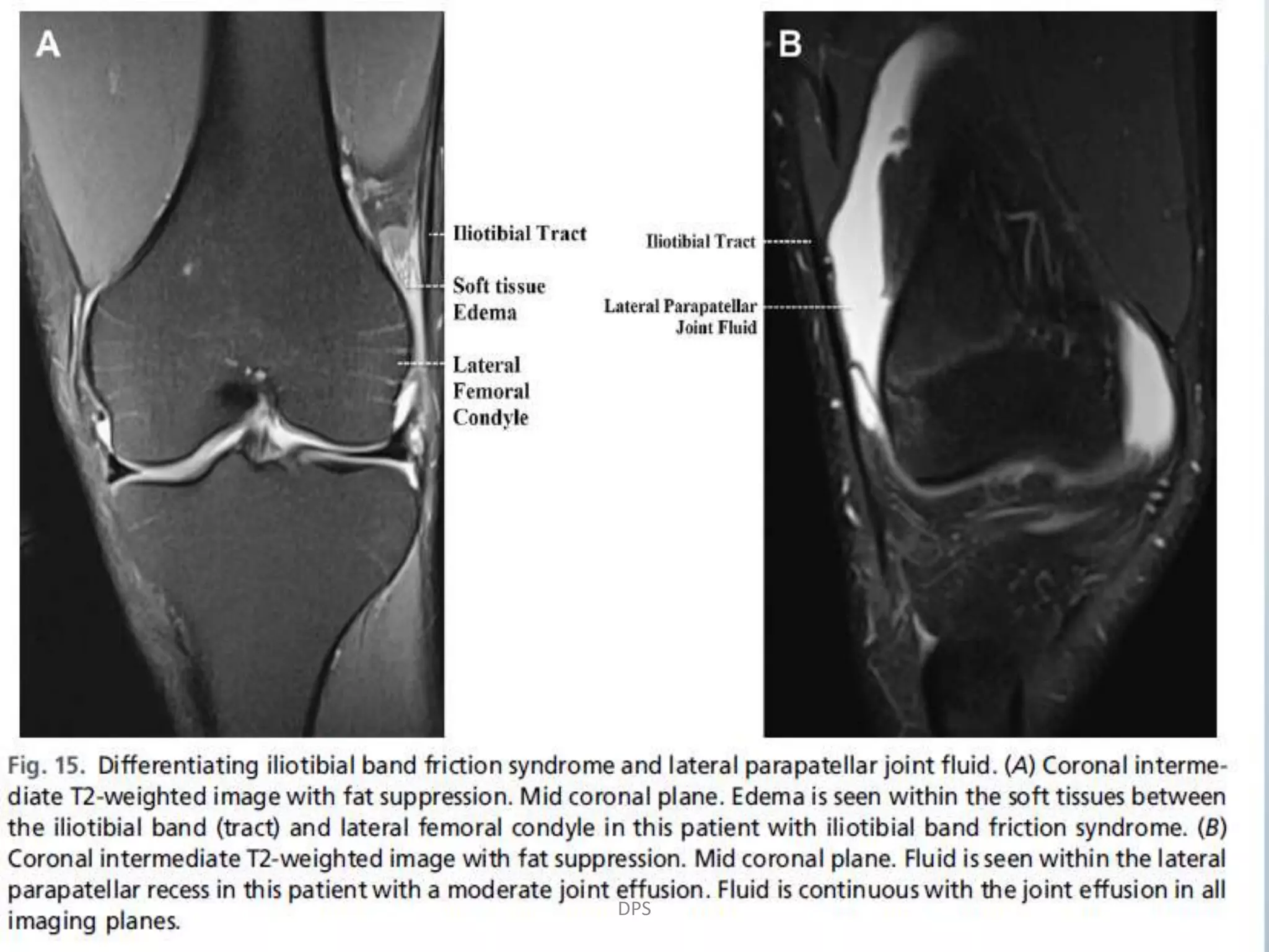 Knee mri: systematic interpretation by dr. d. p. swami | PPT