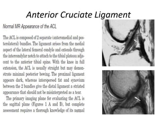 Knee mri: systematic interpretation by dr. d. p. swami | PPTX | Death, Injury, or Military ...